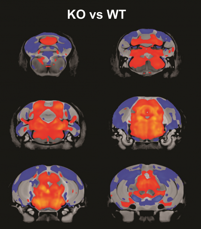 TAOK2 gene causes autism-related changes to brain development and ...
