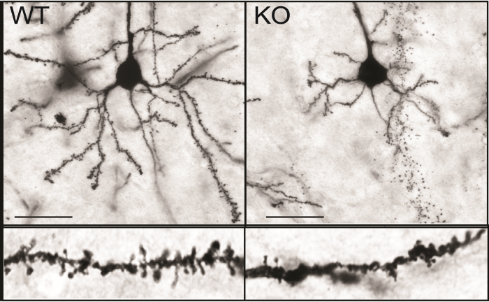 TAOK2 gene causes autism-related changes to brain development and ...